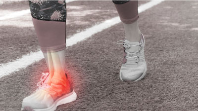 Westminster - Baltimore MD Foot Doctor | MVS Podiatry Associates